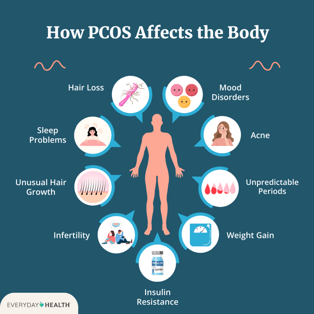 PCOS: Understanding Symptoms, Causes & Treatments